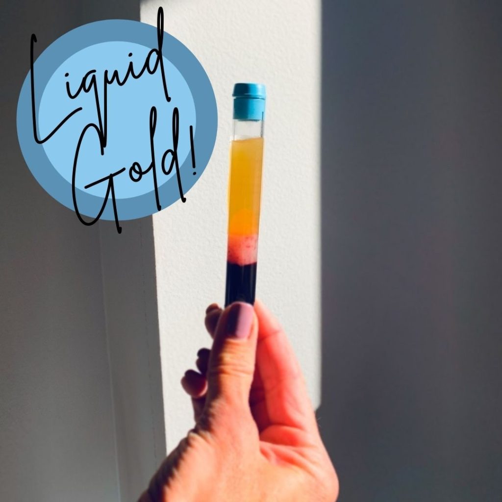 PRP and PRF - Raleigh, NC | Dr. William Stoeckel