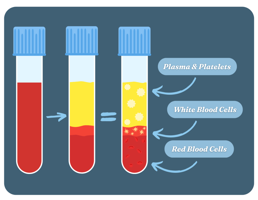 What Are PRF Injectables?